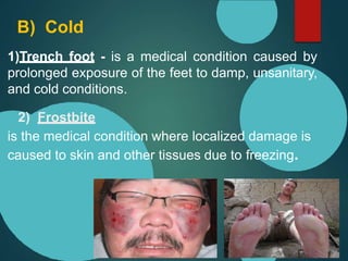 Occupational hazards and pulmonary disease | PPTX