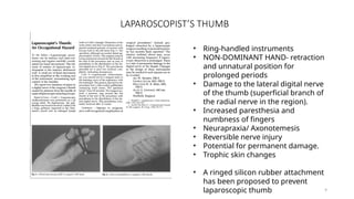 Occupational hazards of a laparoscopic surgeon.pptx