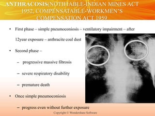 Occupational health | PPTX