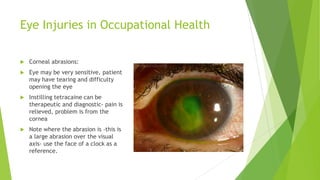 Occupational health25 | PPT