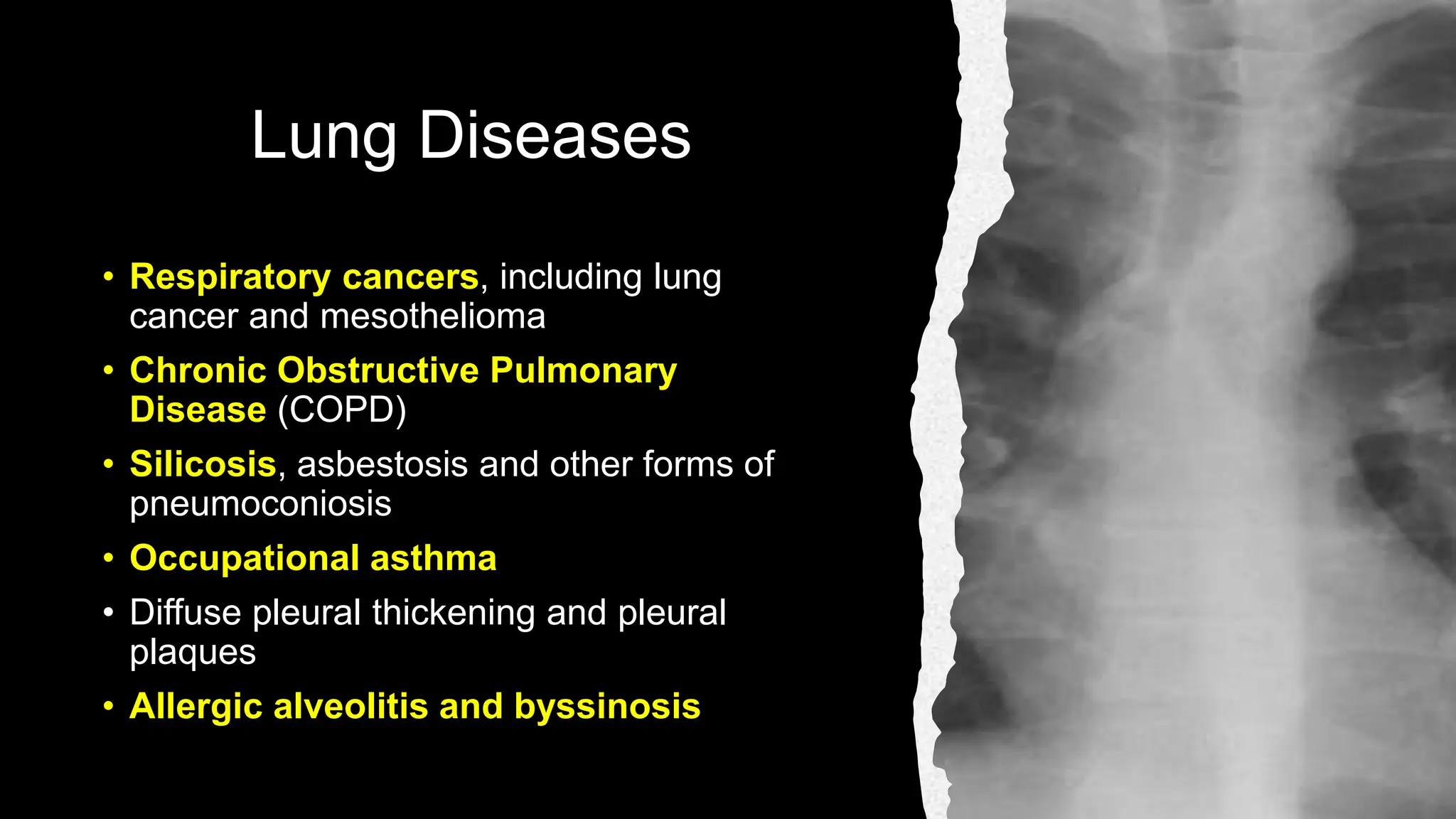 Occupational Lung Disease In United Kingdom Ppt