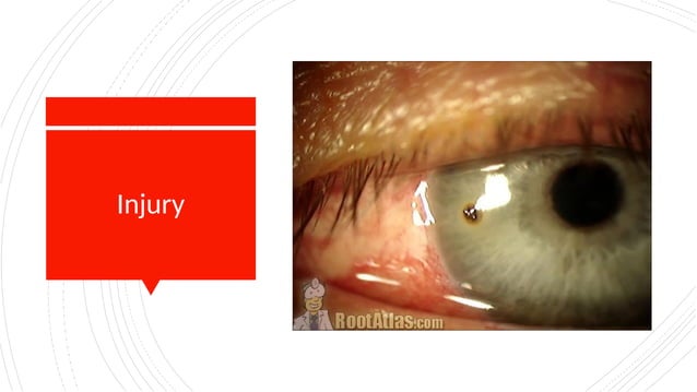 Occupational Optometry Introduction and. | PPTX