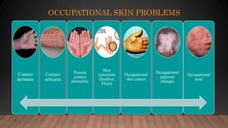 Occupational skin diseases | PPTX | Skin and Dermatology | Diseases and ...