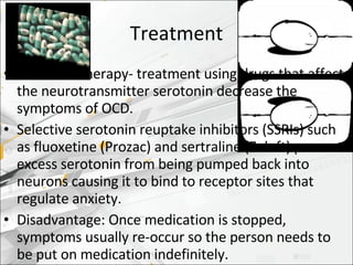 OCD | PPT