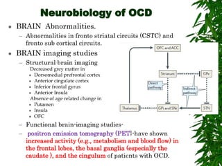BRAIN STIMULATION METHODS IN OCD | PPTX
