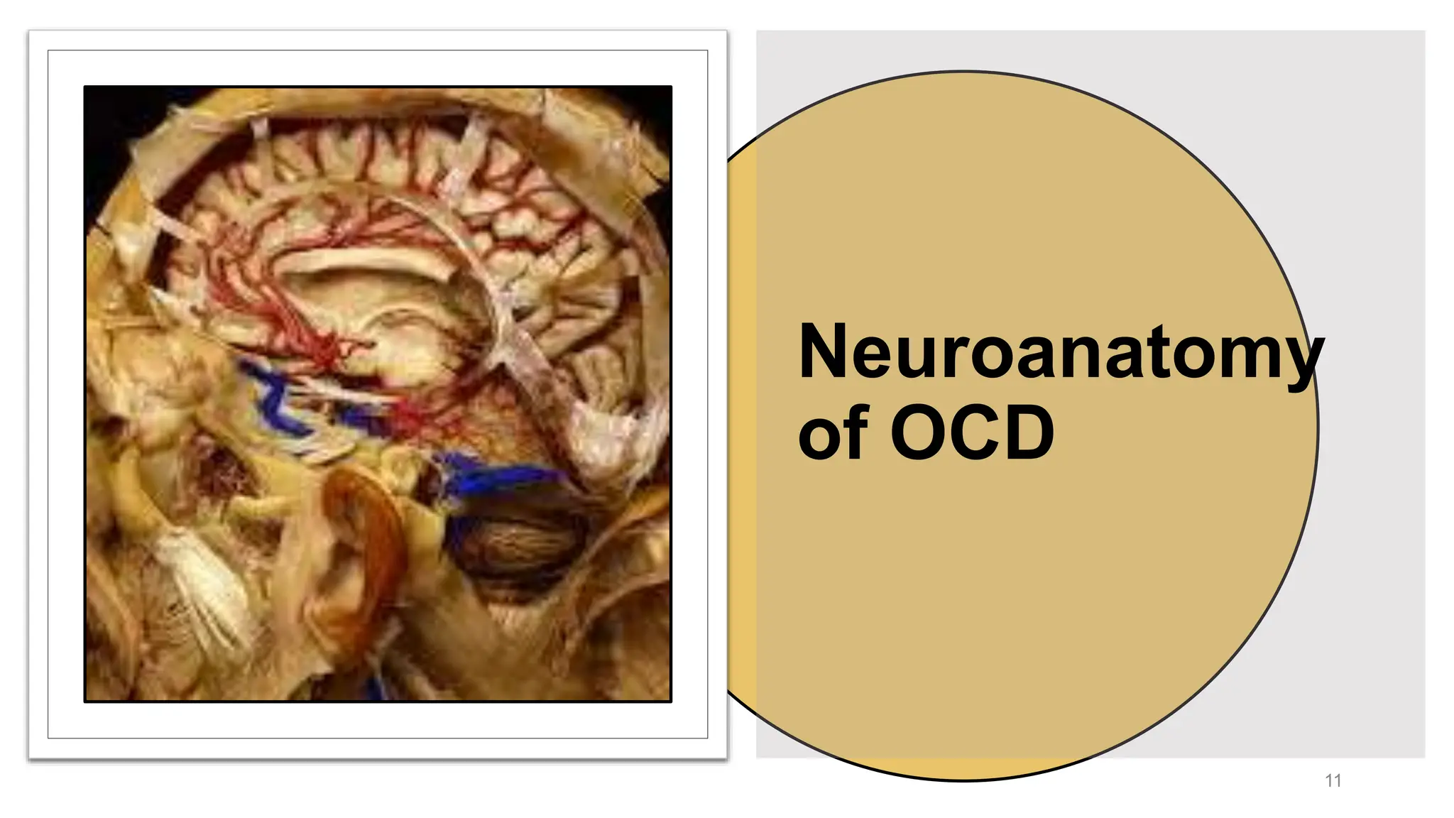 Etiology and neurobiology of obsessive compulsive disorder | PPTX