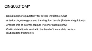 OCD introduction and treatment and management | PPTX