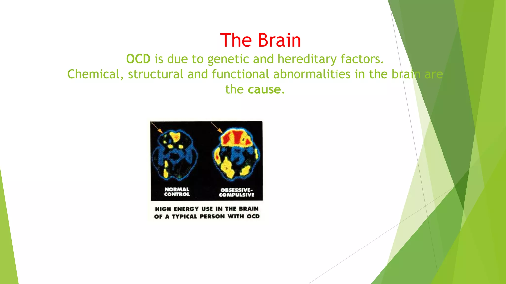 OCD Project: Traci Rodriguez | PPTX