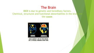 OCD Project: Traci Rodriguez | PPTX