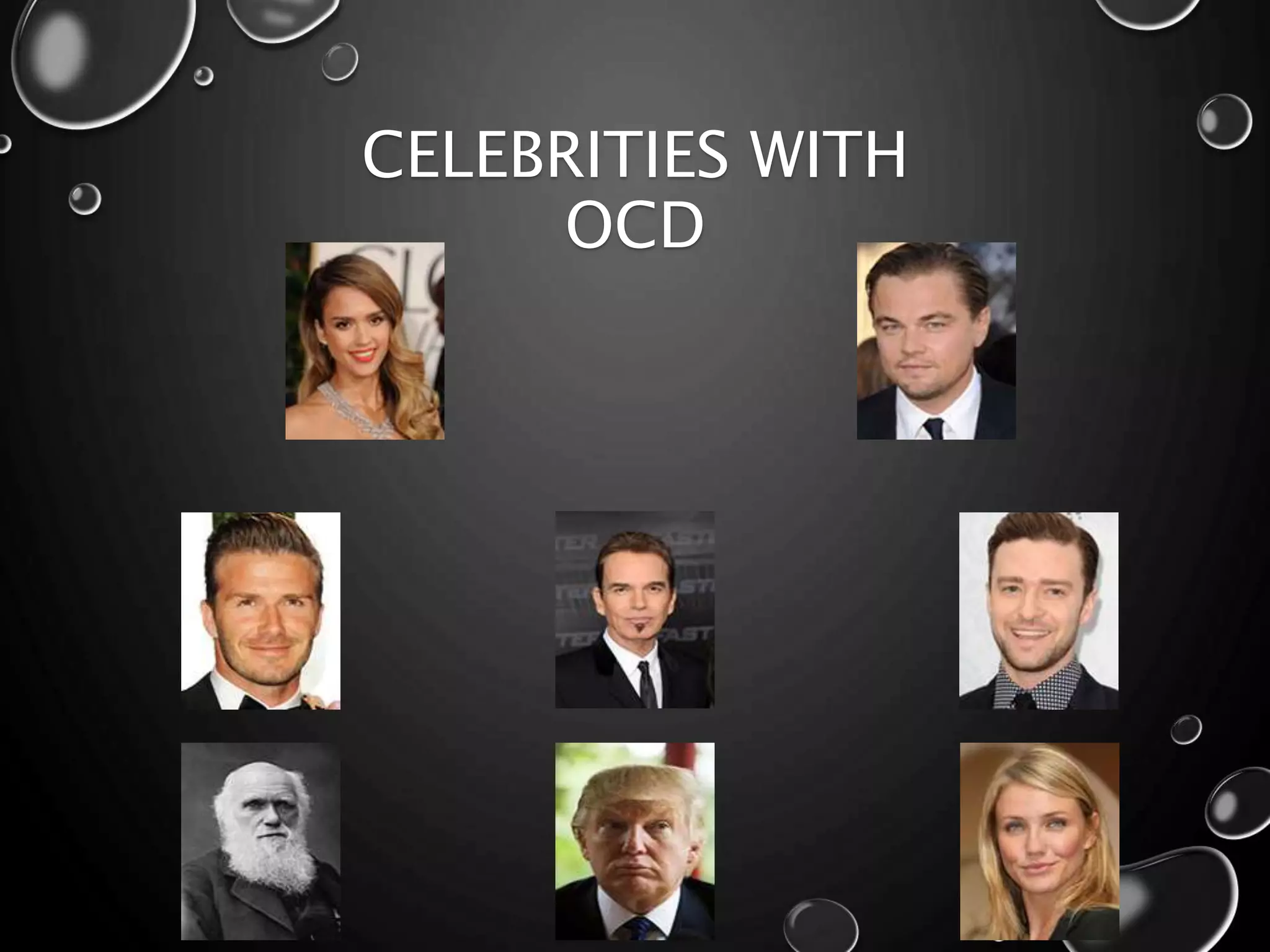 Ocd pathophysiology & updated treatment | PPTX