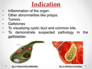 OCG (Oral cholecystogram) BY Akash Das | PPTX