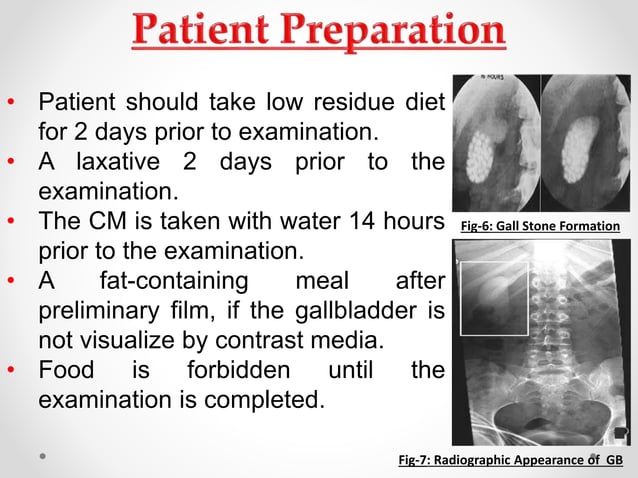OCG (Oral cholecystogram) BY Akash Das | PPTX | Digestive Disorders ...