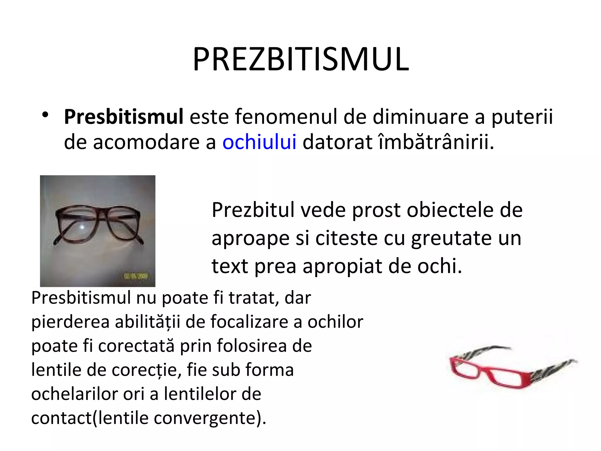Ochiul. defecte de vedere | PPT