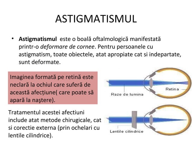 Ochiul. defecte de vedere | PPT