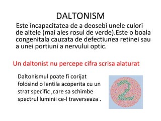 Ochiul. defecte de vedere | PPT