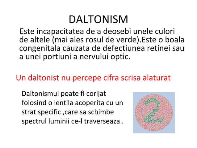 Ochiul. defecte de vedere | PPT