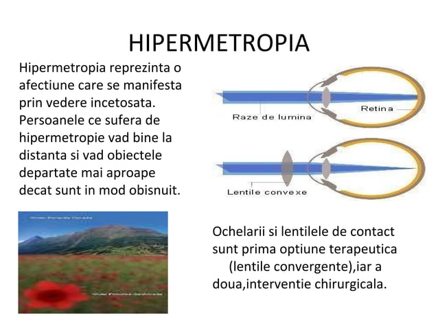 Ochiul. defecte de vedere | PPT