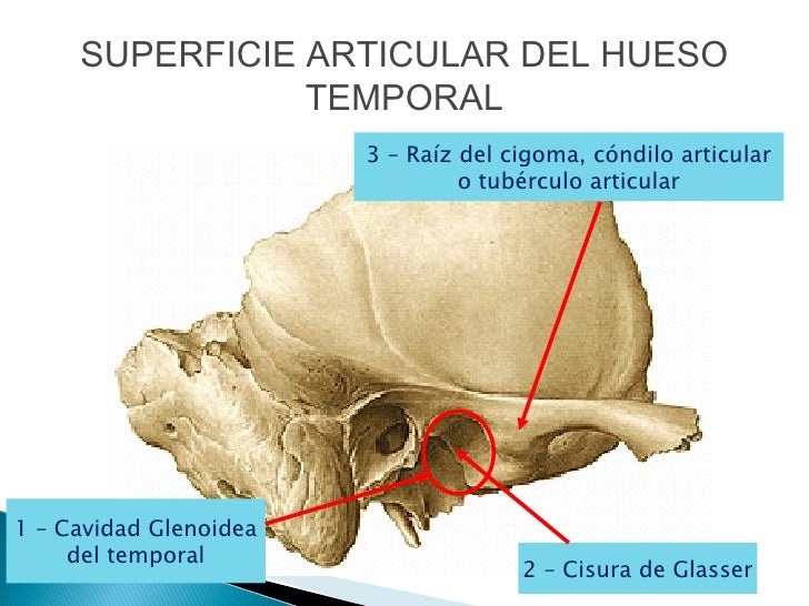 OclusióN ArticulacióN Temporomandibular