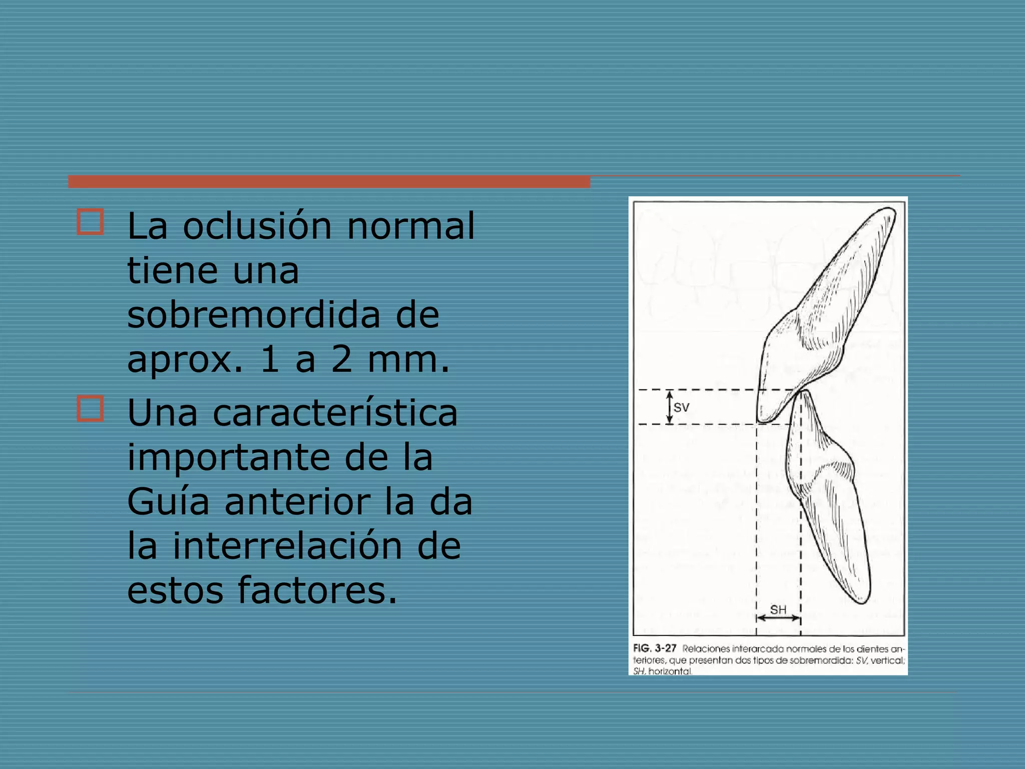 Oclusión en prótesis | PPT