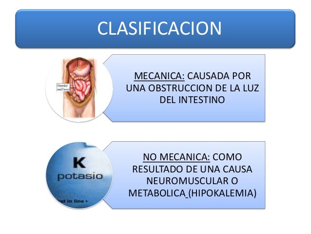 Oclusión intestinal 2012