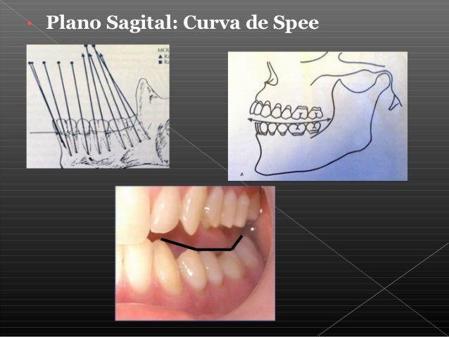 Oclusion dental