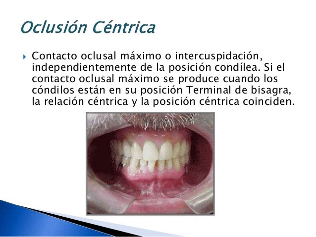 Oclusion best