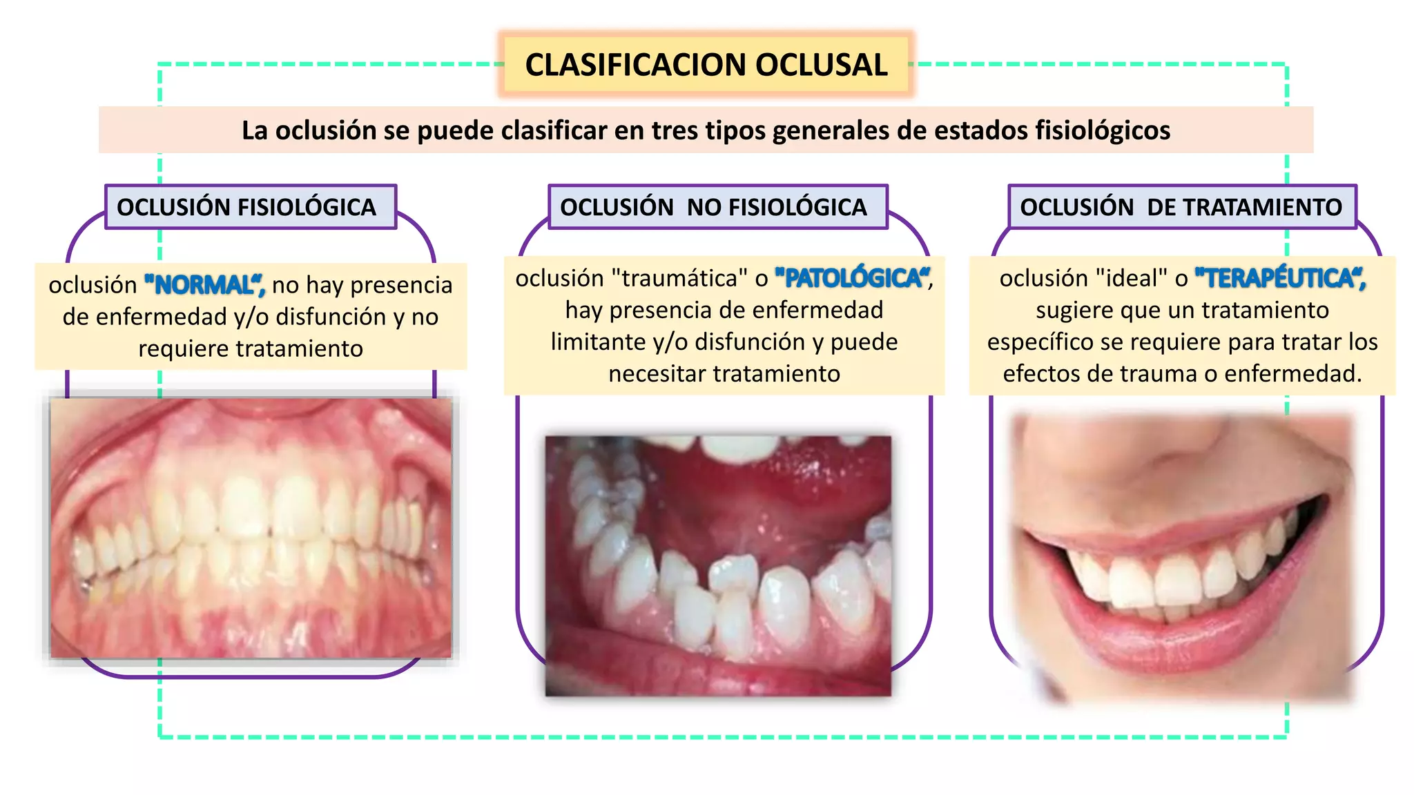 Oclusion dental alineacion y oclusion de los dientes oclusion ...