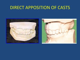 Oclusionin removable partial denture | PPTX