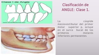 oclusion patologicA.pptx