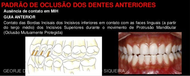 Oclusão dentária protec 2013