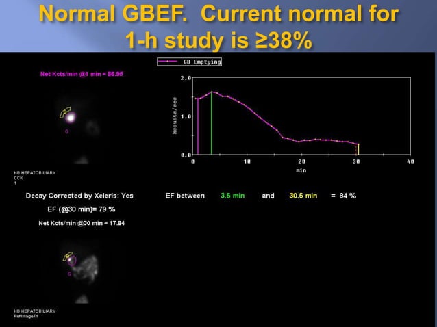 Call prep: emergency nuclear medicine procedures | PPT