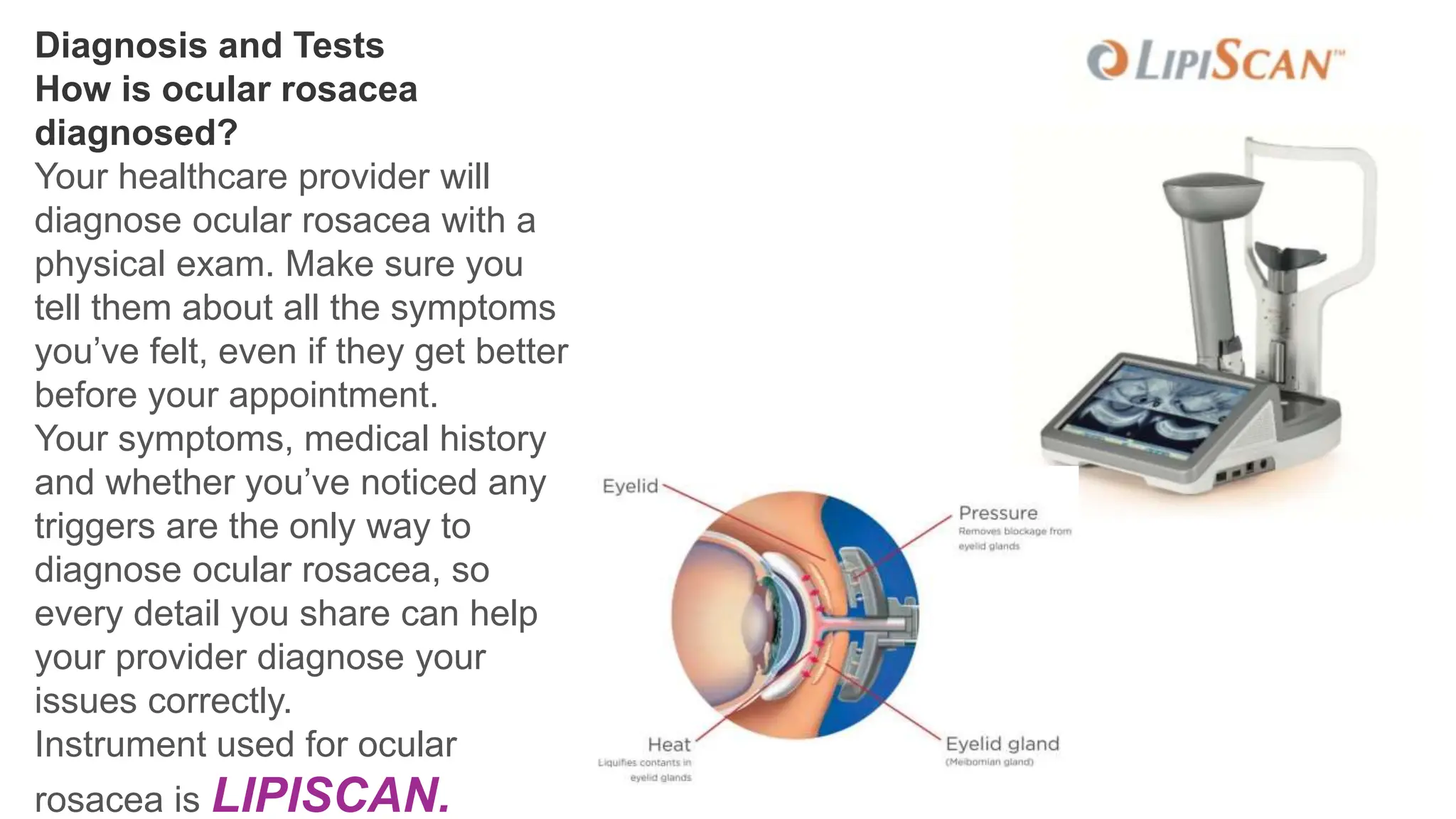 OCULAR ROSACEA: Introduction, symptoms and causes, Diagnosis ...