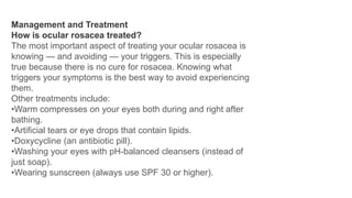 OCULAR ROSACEA: Introduction, symptoms and causes, Diagnosis ...