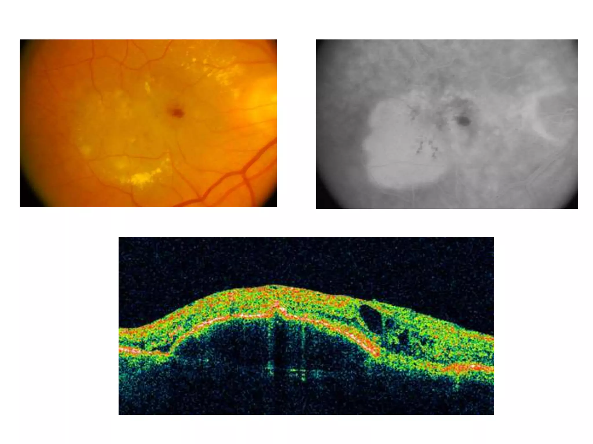 Optical coherence tomography | PPTX