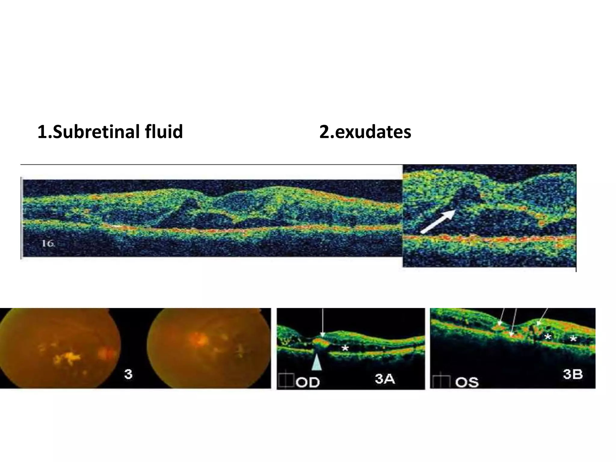 Optical coherence tomography | PPTX