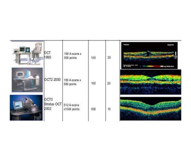 Optical coherence tomography | PPTX