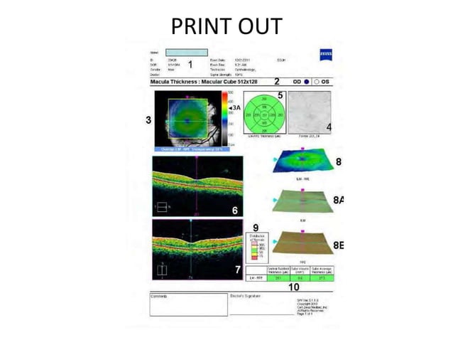Optical coherence tomography | PPTX