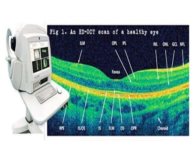 Optical coherence tomography | PPTX