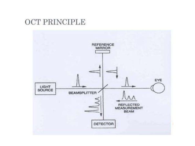 Optical coherence tomography | PPTX