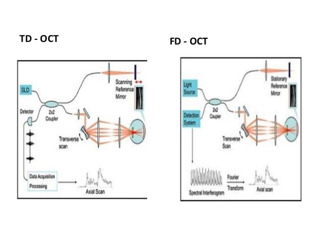 Optical coherence tomography