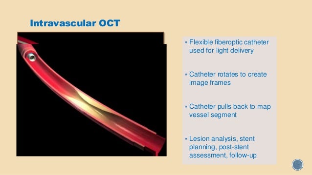 OPTICAL COHERENCE TOMOGRAPHY