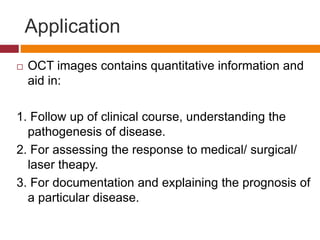 OCT in Ophthalmology | PPTX