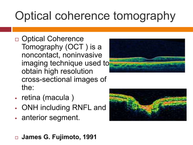 OCT in Ophthalmology | PPTX