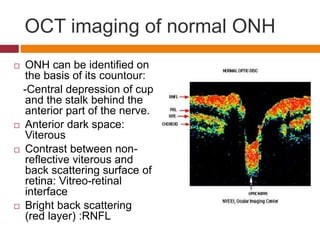 OCT in Ophthalmology | PPTX