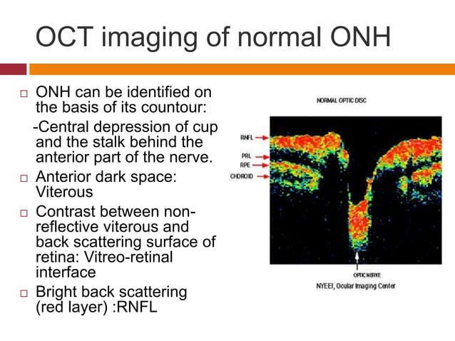OCT in Ophthalmology | PPTX