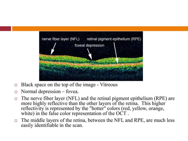 OCT in Ophthalmology | PPTX