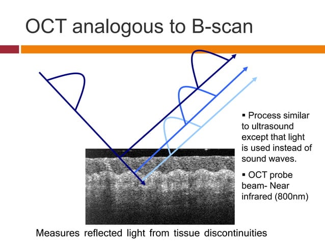 OCT in Ophthalmology | PPTX