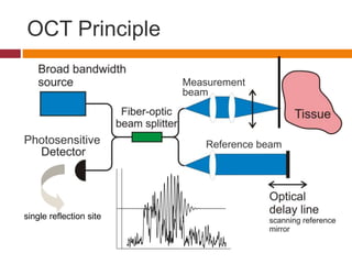 OCT in Ophthalmology | PPTX