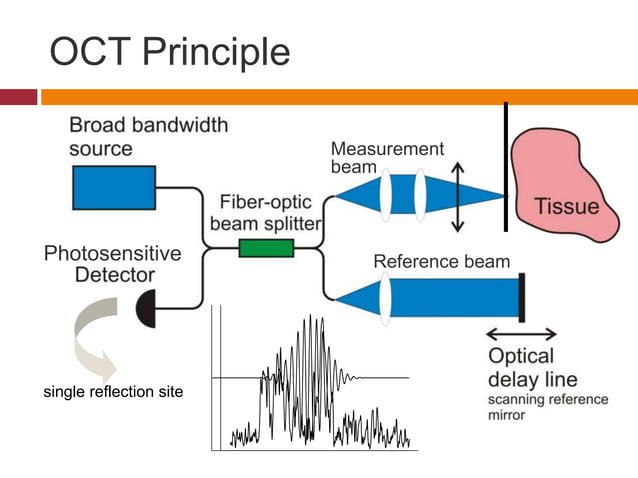 OCT in Ophthalmology | PPTX