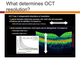 OCT in Ophthalmology | PPTX